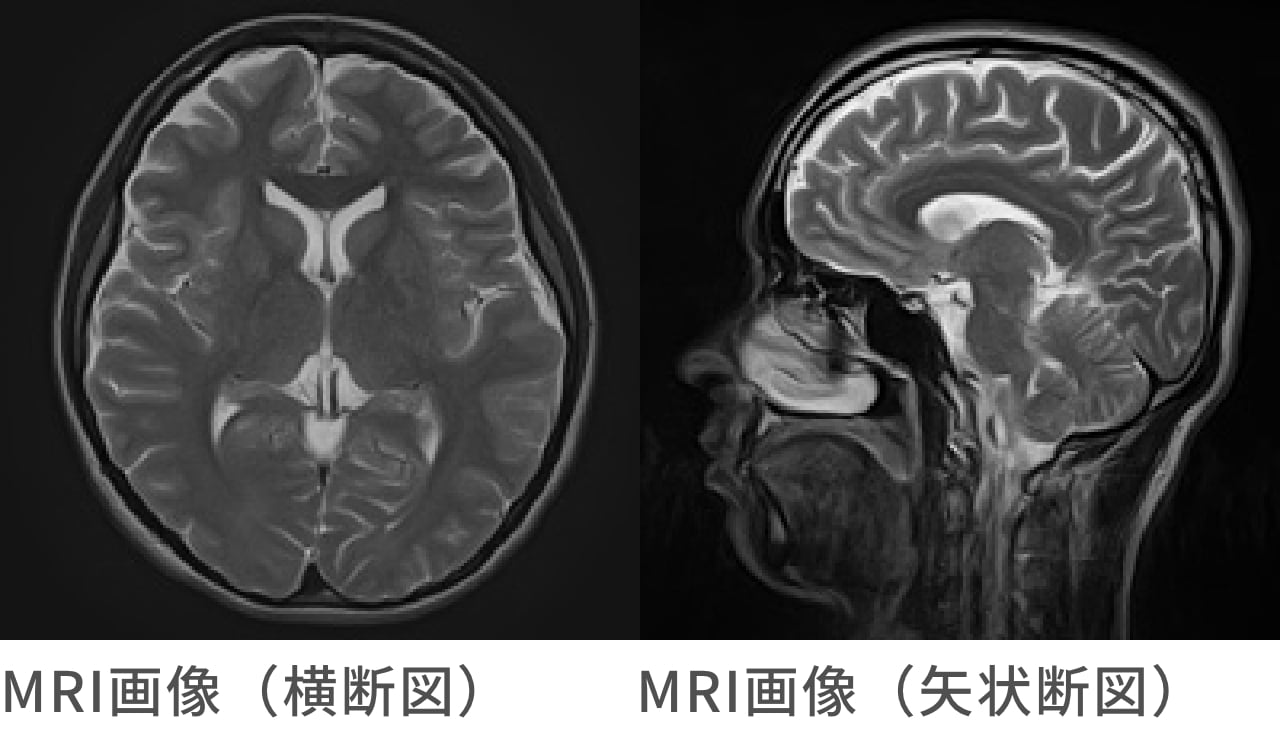 頭部MRI・MRA単体検査 | 人間ドックのアムス丸の内パレスビルクリニック（東京）